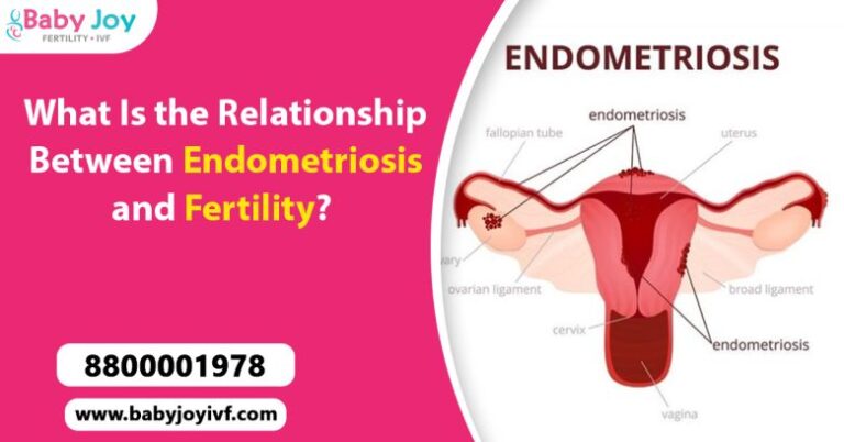 What is the Relationship Between Endometriosis and Fertility? By Best ...